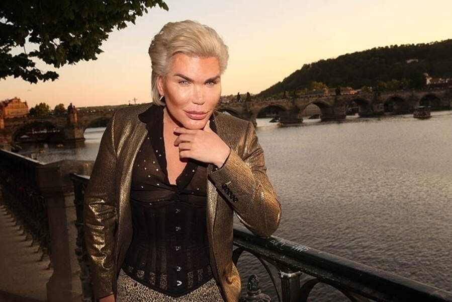 Rodrigo Alves, surnommé le “Ken humain” : son évolution en images - Femme Actuelle