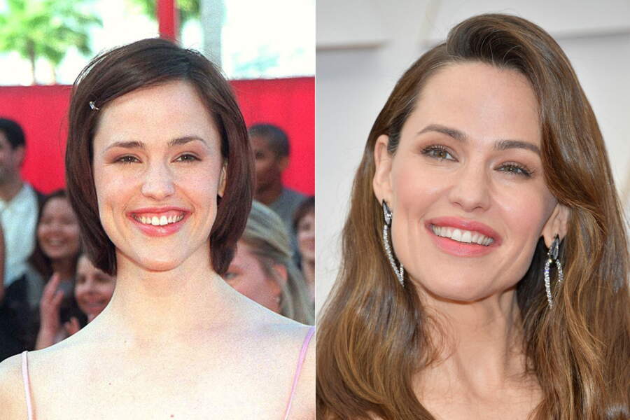 Avant/après : ces stars qui ont refait leurs dents - Femme Actuelle